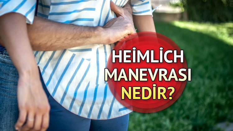 En önemli ilk yardım tekniklerinden... Heimlich manevrası nedir, nasıl ...