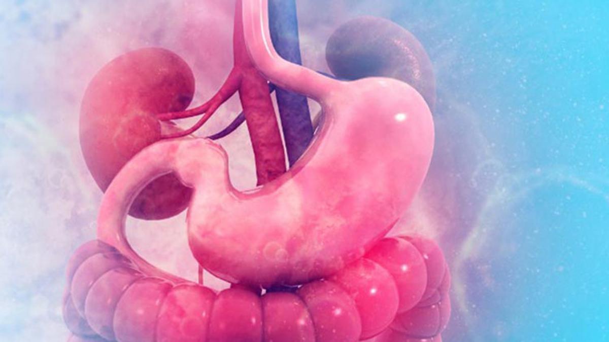 Gastrit Nedir, Neden Olur? Gastrit Belirtileri ve Tedavisi - Mahmure