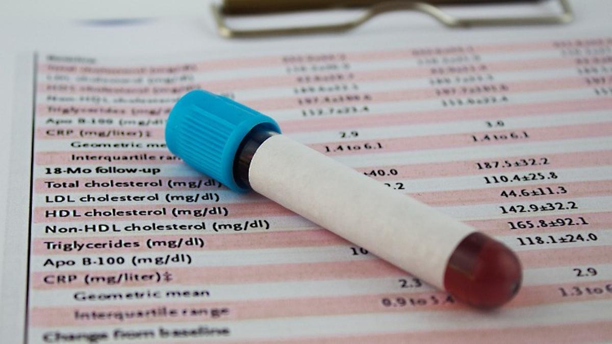 Hormon testi nasıl yapılır?