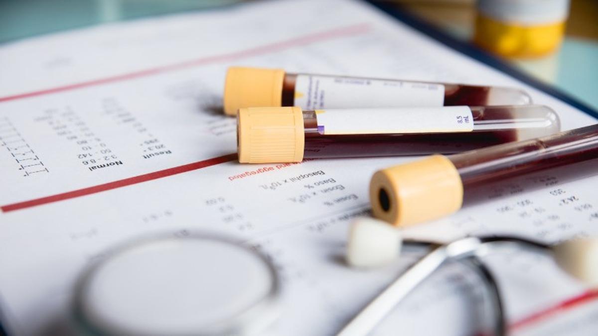 Hormon testi nedir, ne zaman yapılır? Adetliyken hormon testi nasıl ...