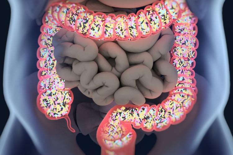 Chron Hastalığı Nedir, Neden Olur? İşte Chron Hastalığının Belirtileri ...