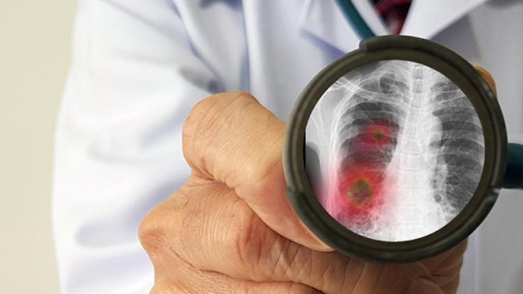 Tridemi nedir? İşte Tridemi hakkında bilgiler