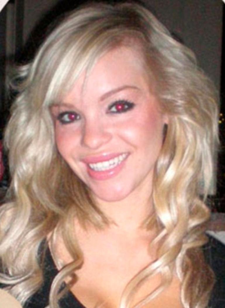 Yüzü asitle yanıp tanınmaz hale gelen sunucu Katie Piper Batman ...